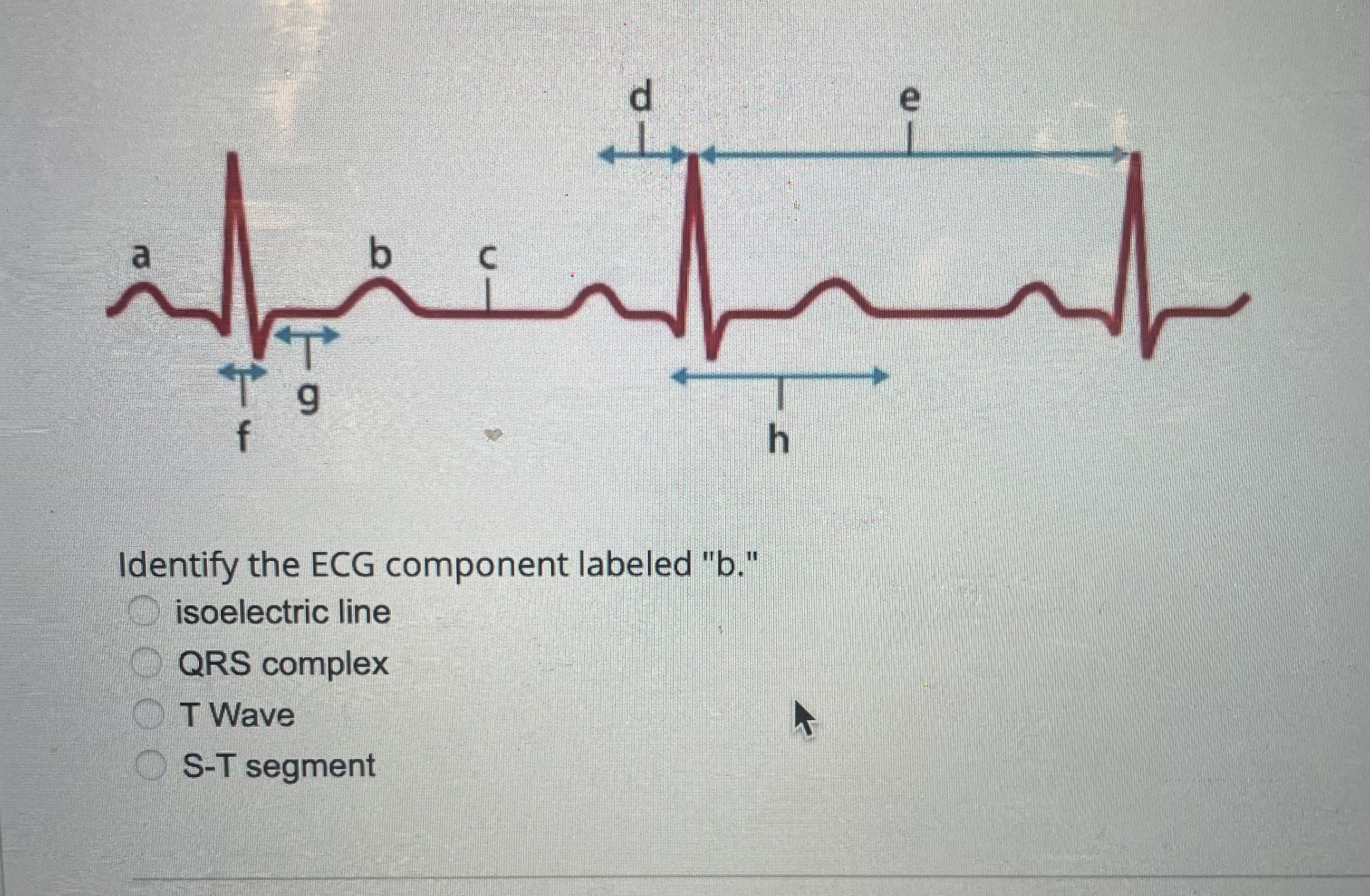 Solved Identify the ECG component labeled "b."isoelectric | Chegg.com