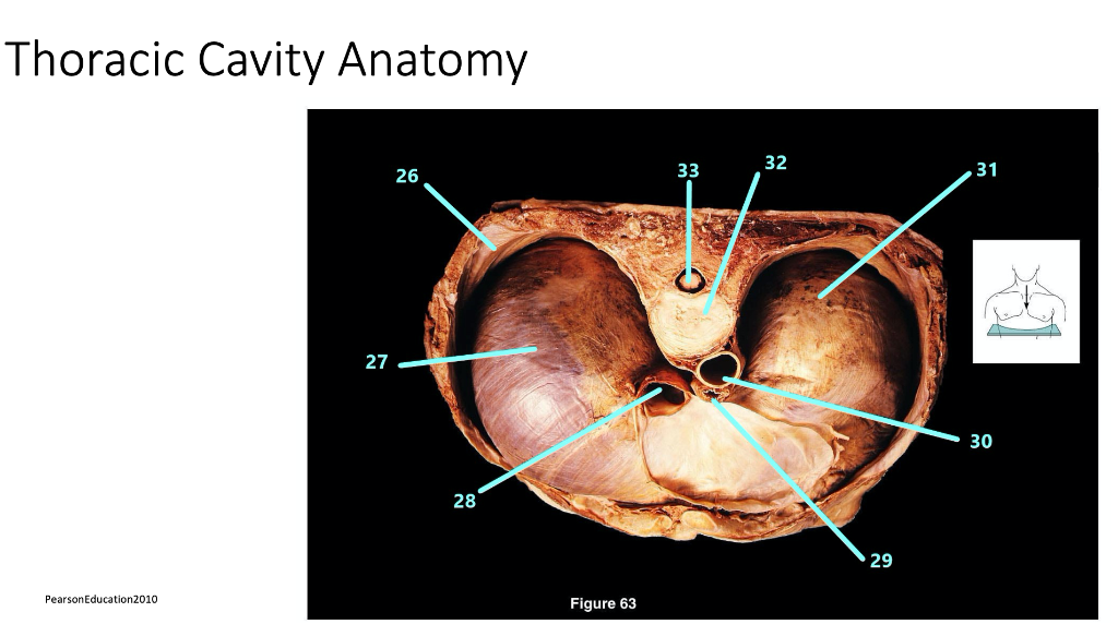 Solved Thoracic Cavity Anatomy | Chegg.com