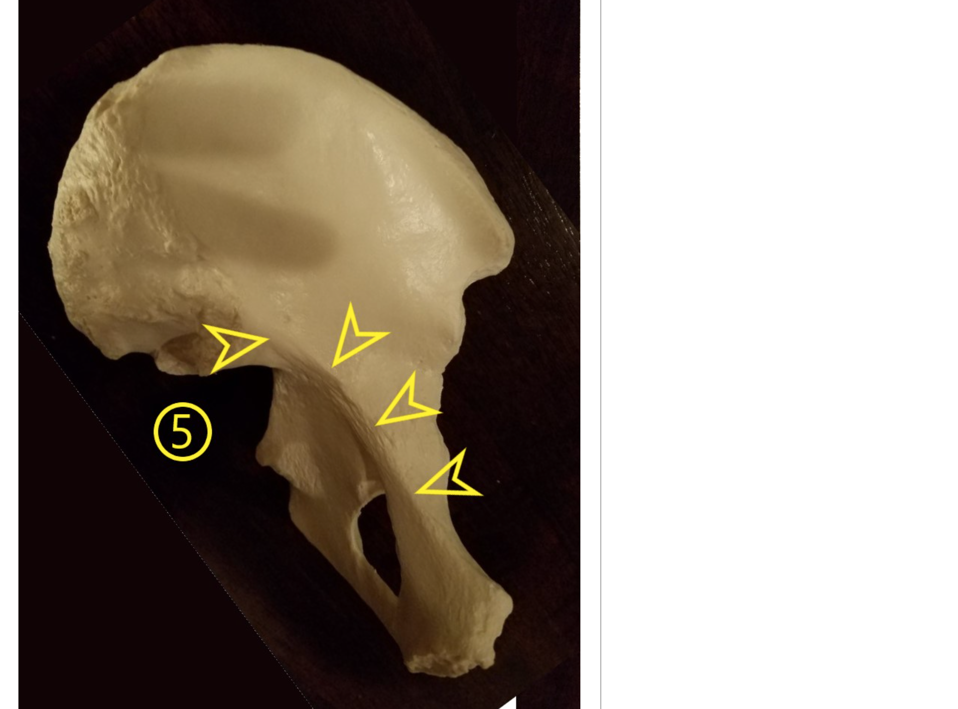 Solved List the name of the bone | Chegg.com