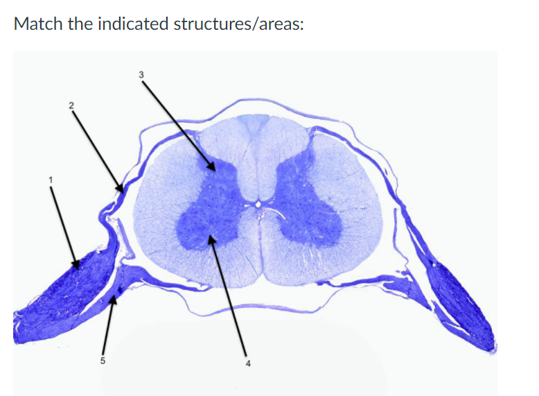 Solved Options are; dorsal horn, ventral horn, dorsal root, | Chegg.com