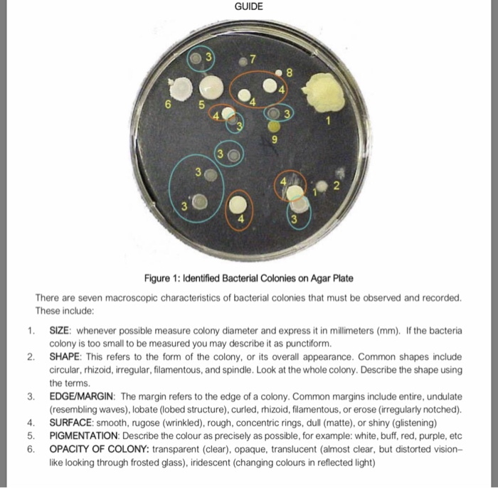 Solved Theory: Microbes grow on solid media as colonies. A | Chegg.com