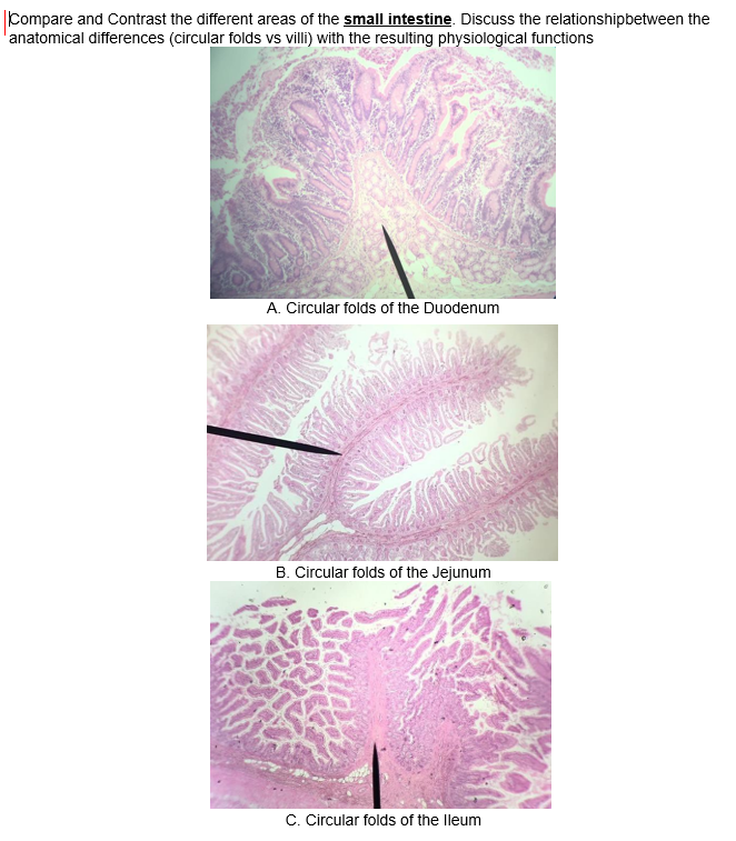 Solved Compare and Contrast the different areas of the small | Chegg.com