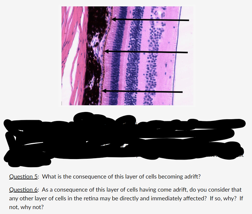 Solved Question 5: What is the consequence of this layer of | Chegg.com