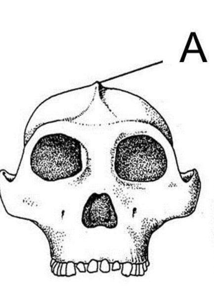 Solved What is the name of the feature labeled “A” in this | Chegg.com