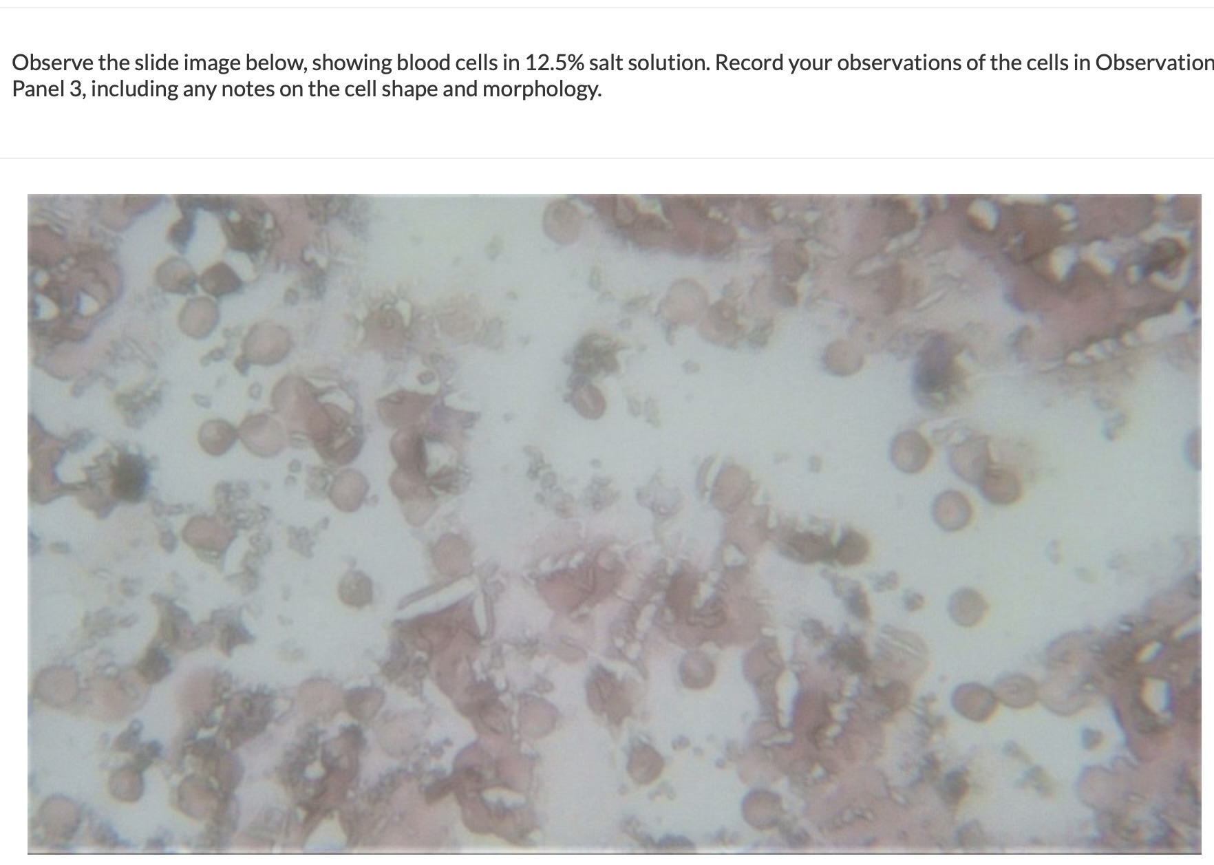 Solved Exercise 1 Observation of Osmosis in Red Blood Cells | Chegg.com