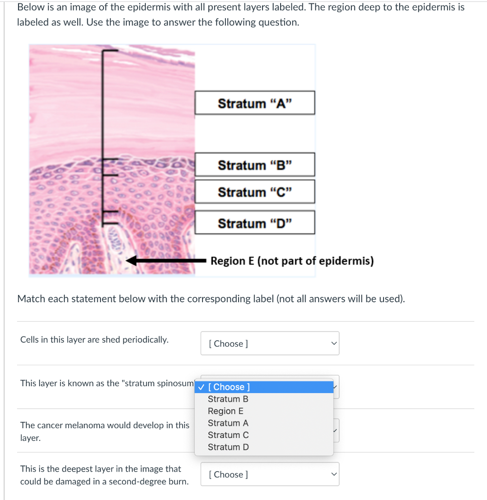 Solved Below is an image of the epidermis with all present | Chegg.com