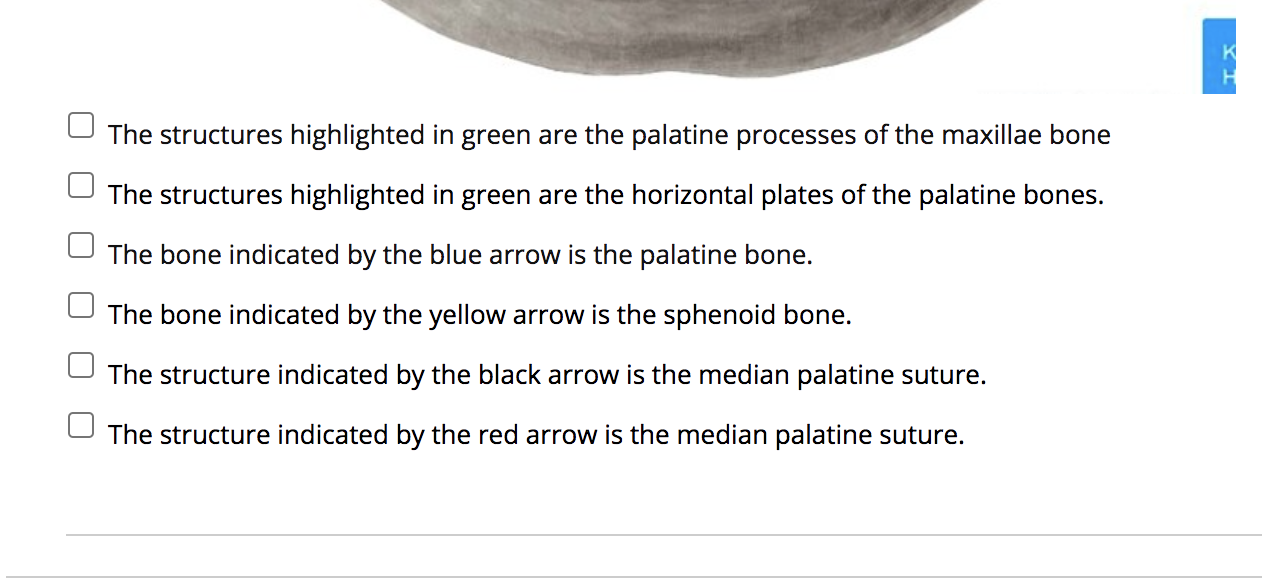 Solved The structures highlighted in green are the palatine | Chegg.com