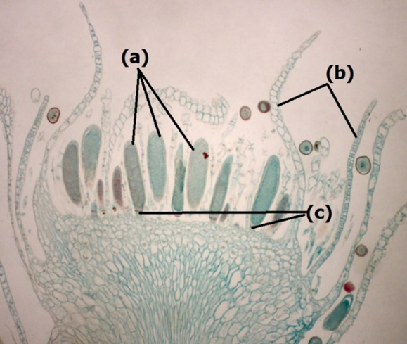 Solved Below is a micrograph of a prepared slide of a | Chegg.com