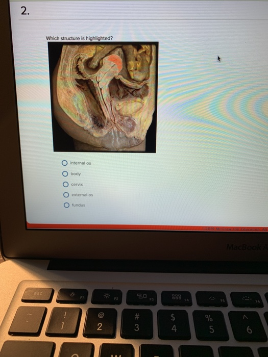 Solved 1. Which structure is highlighted? O prepuce O corpus | Chegg.com