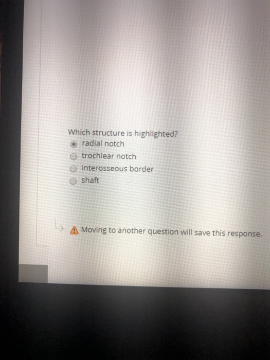 Solved Which structure is highlighted? radial notch e | Chegg.com