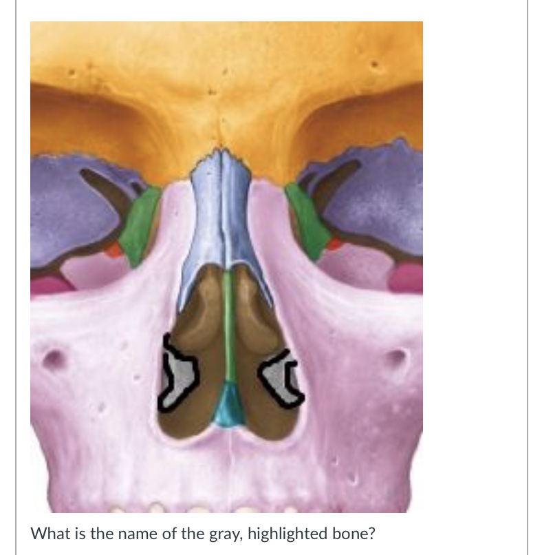 Solved What is the name of the gray, highlighted bone? | Chegg.com