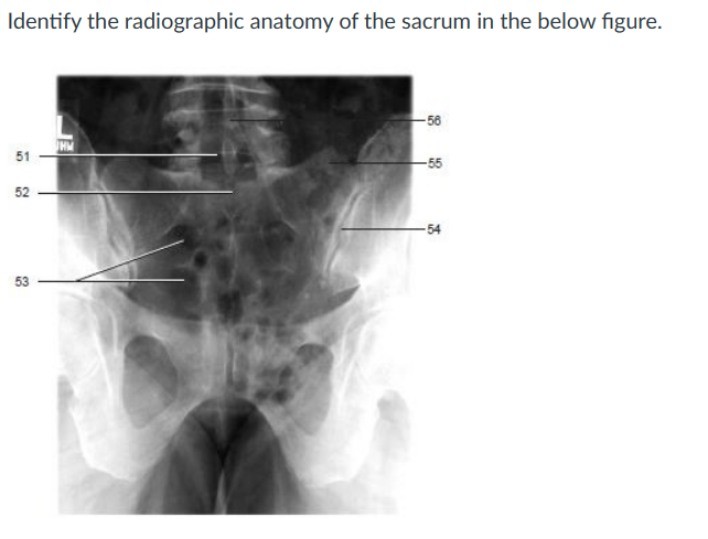 Solved Identify the radiographic anatomy of the sacrum in | Chegg.com