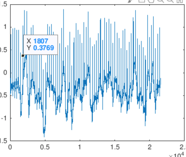 Write A Matlab Code That Will Filter A Noisy Ecg