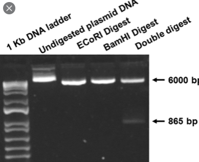 Solved I'd like to know why the undigested plasmid seems to | Chegg.com