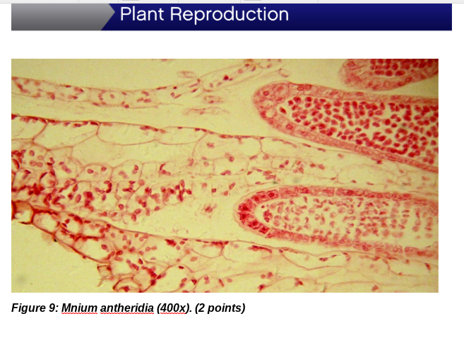 Solved Plant Reproduction Figure 9: Mnium antheridia (400x). | Chegg.com