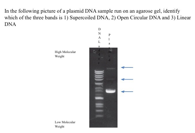 Solved In the following picture of a plasmid DNA sample run | Chegg.com