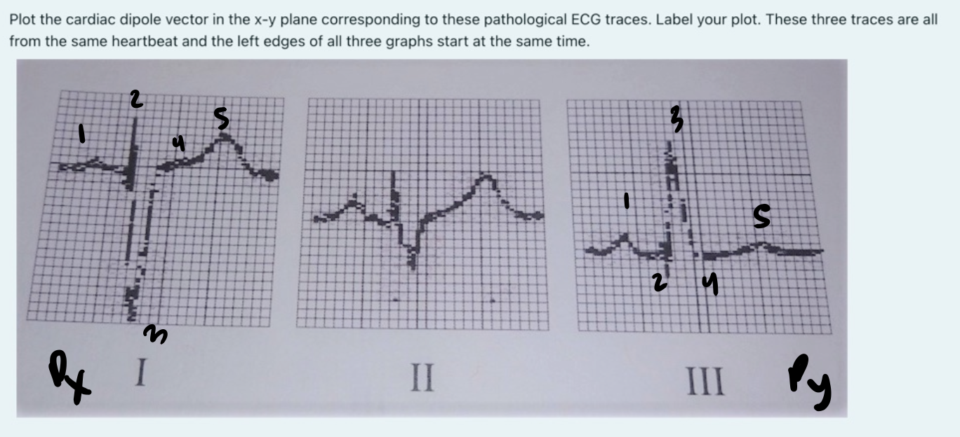 Solved Plot the cardiac dipole vector in the x-y plane | Chegg.com