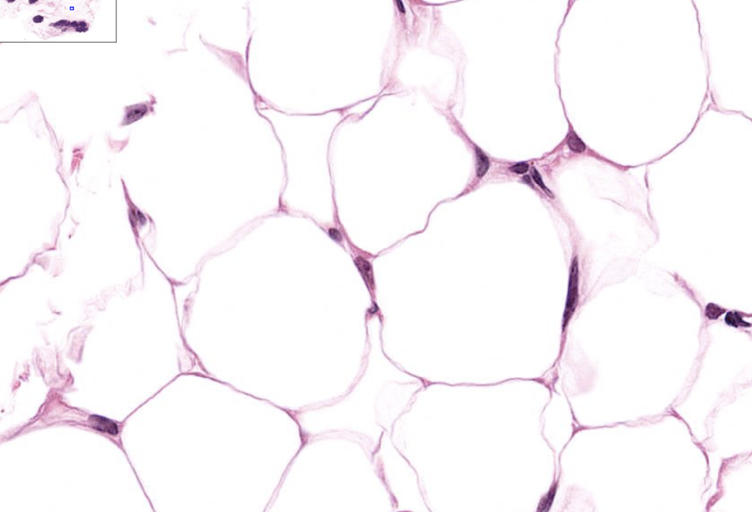 Solved This is a Adipose tissue, please use ARROWS | Chegg.com
