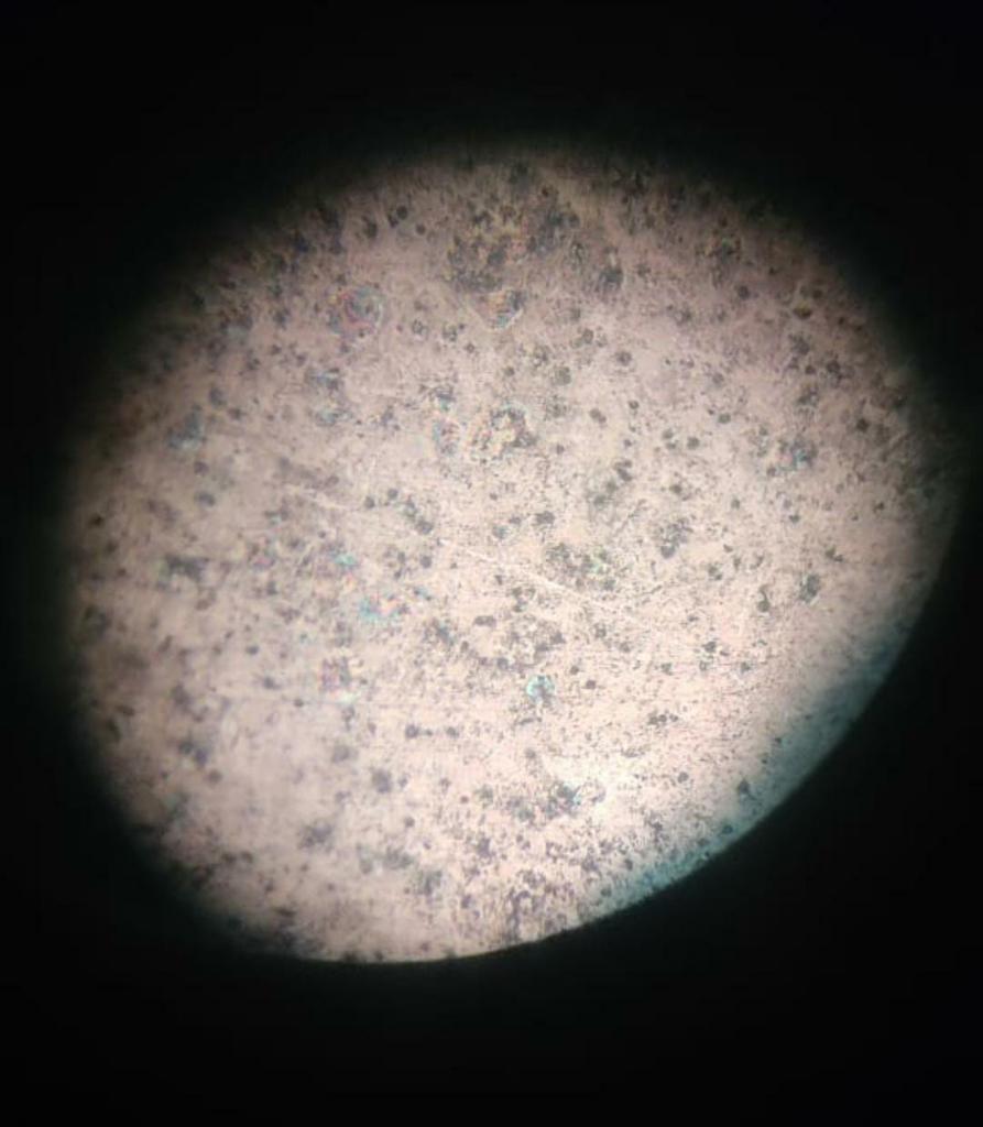 Solved The given steel microstructure is spheroidite. | Chegg.com