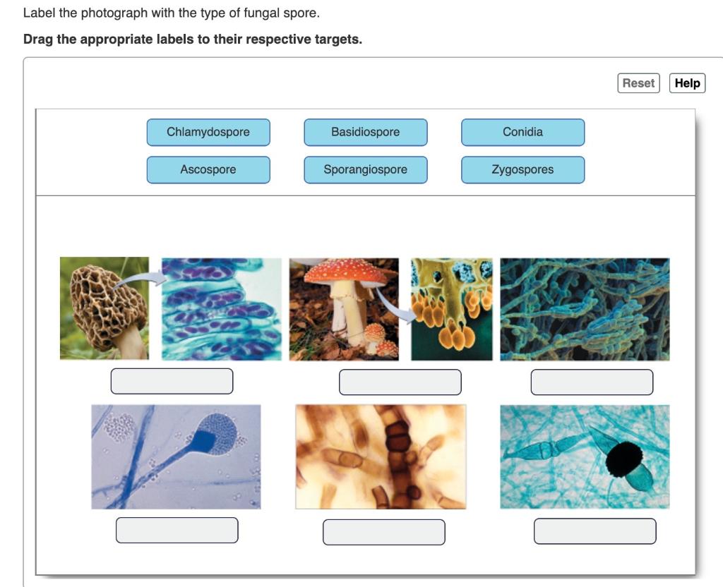 Solved Label the photograph with the type of fungal spore. | Chegg.com