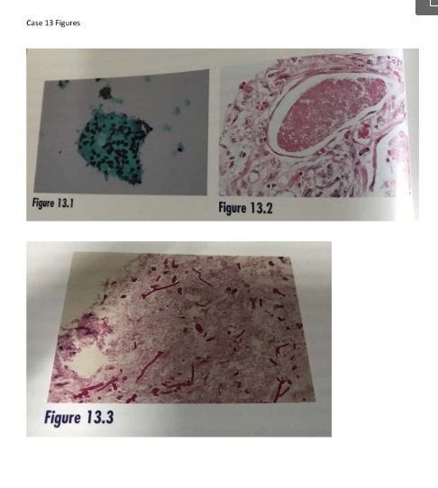 Solved Microbiology Case Study: The patient was a | Chegg.com