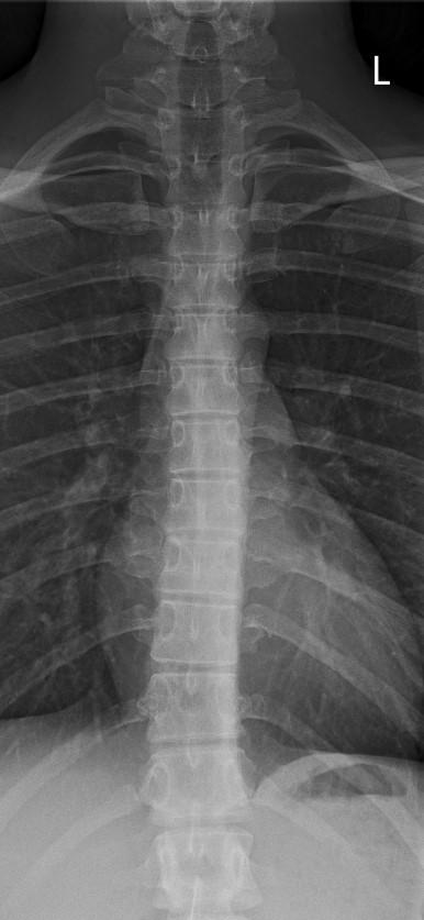 Solved 1. Locate the left L2 transverse process. Locate | Chegg.com