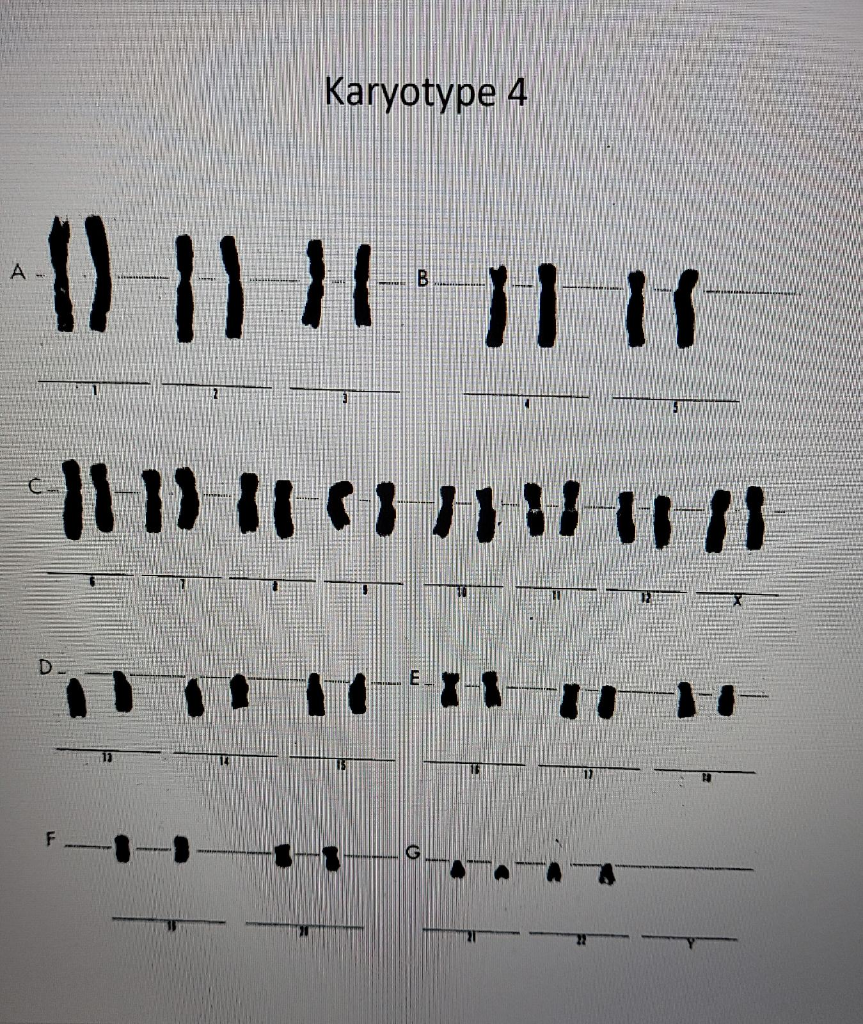 Solved Eqoys Table 9.2 Examples of Human Diseases Detectable | Chegg.com