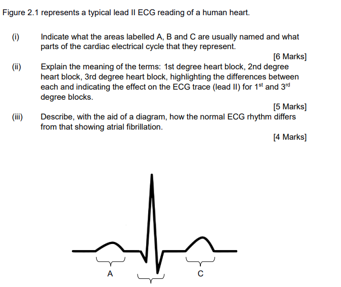 Solved Figure 2.1 represents a typical lead II ECG reading | Chegg.com