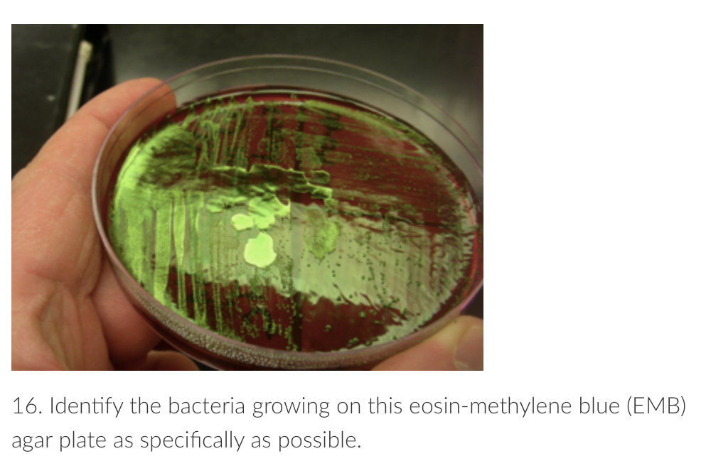 Solved Identify the bacteria growing on this eosin-methylene | Chegg.com