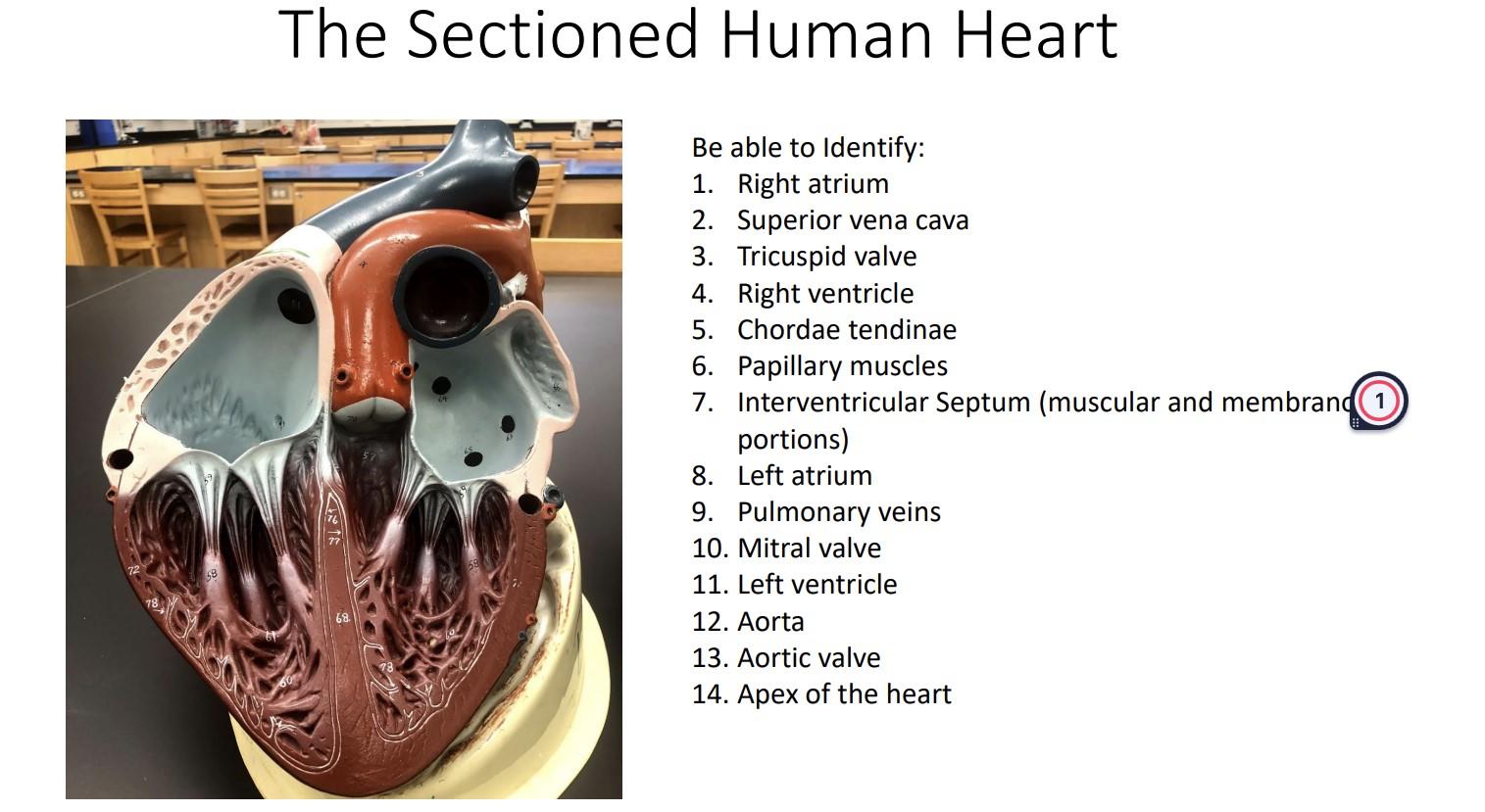 Solved Using arrows point to the location where the | Chegg.com