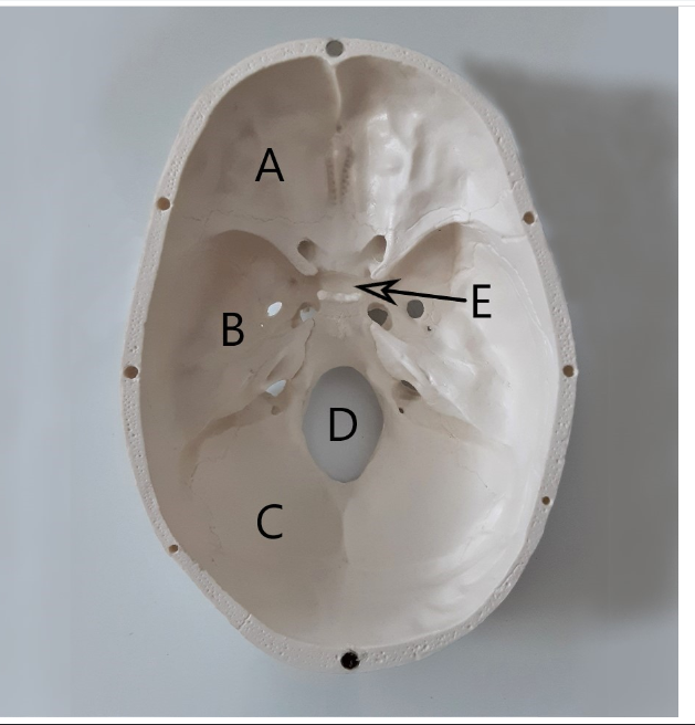 Solved 1.The projection "A" is [ Select ] ["zygomatic | Chegg.com