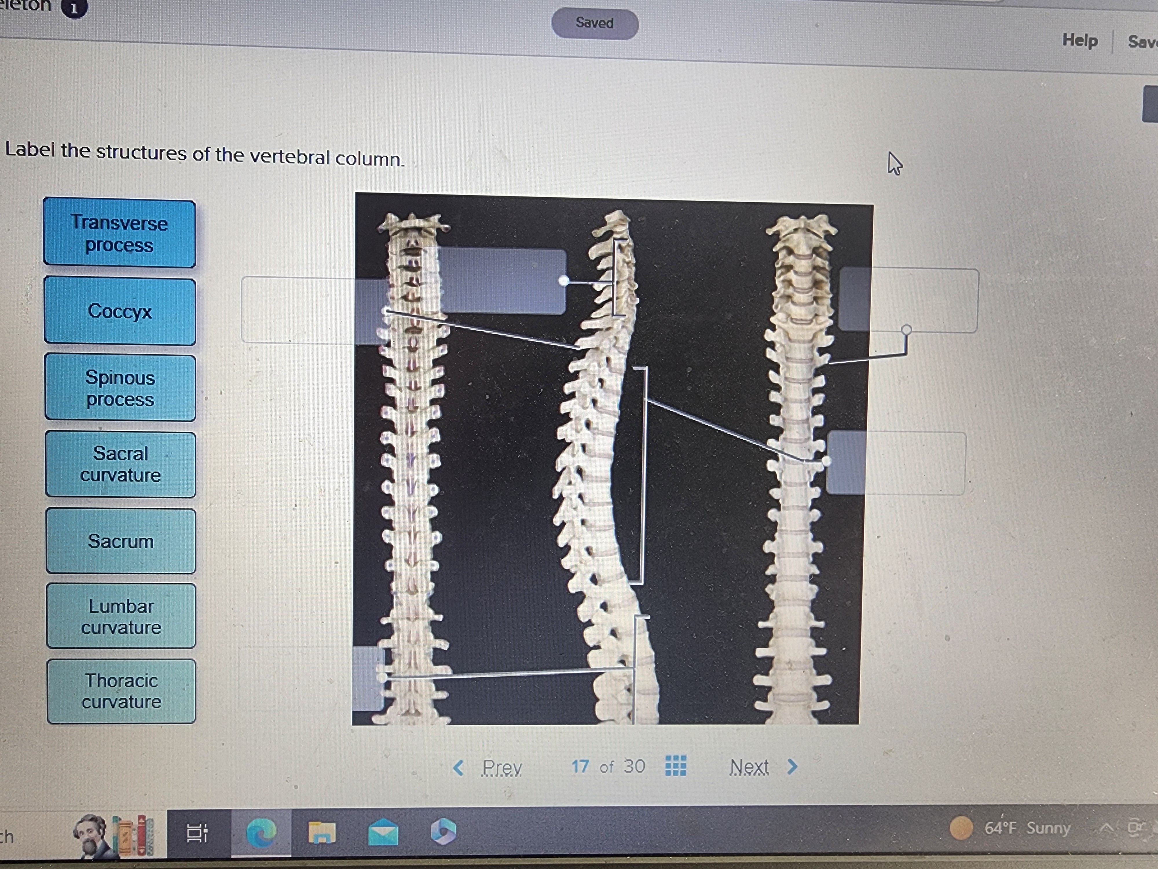 Solved Label the structures of the vertebral column. | Chegg.com
