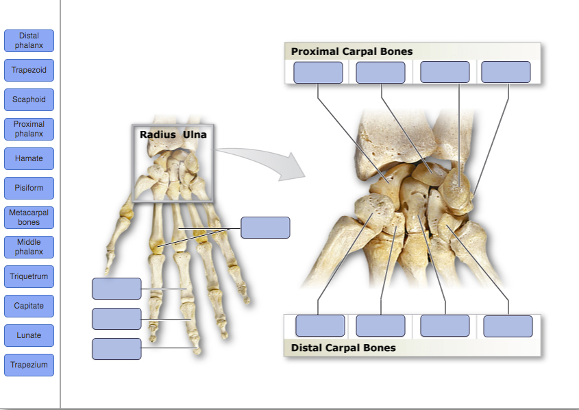 Solved Distal phalanx Proximal Carpal Bones Trapezoid | Chegg.com