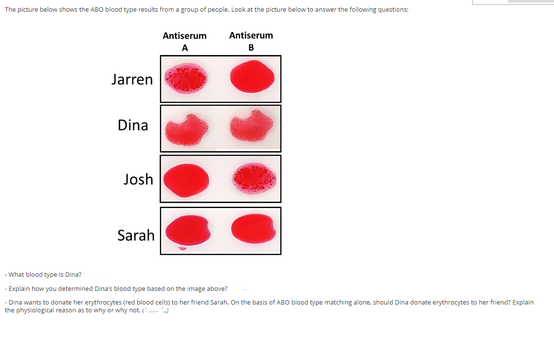 Solved The picture below shows the ABO blood type results | Chegg.com
