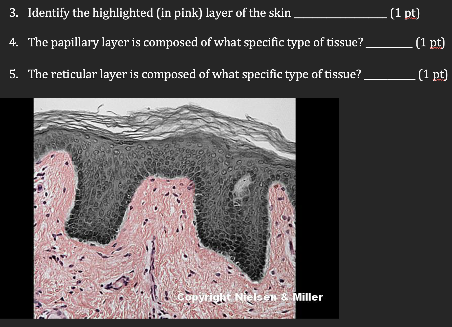 Solved 3. Identify the highlighted (in pink) layer of the | Chegg.com