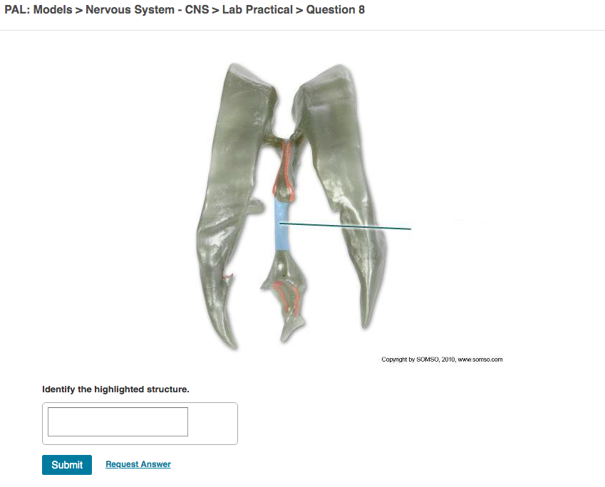 Solved PAL: Models > Nervous System - CNS > Lab Practical > | Chegg.com