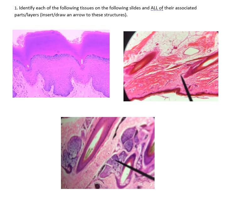 Solved 1. Identify each of the following tissues on the | Chegg.com
