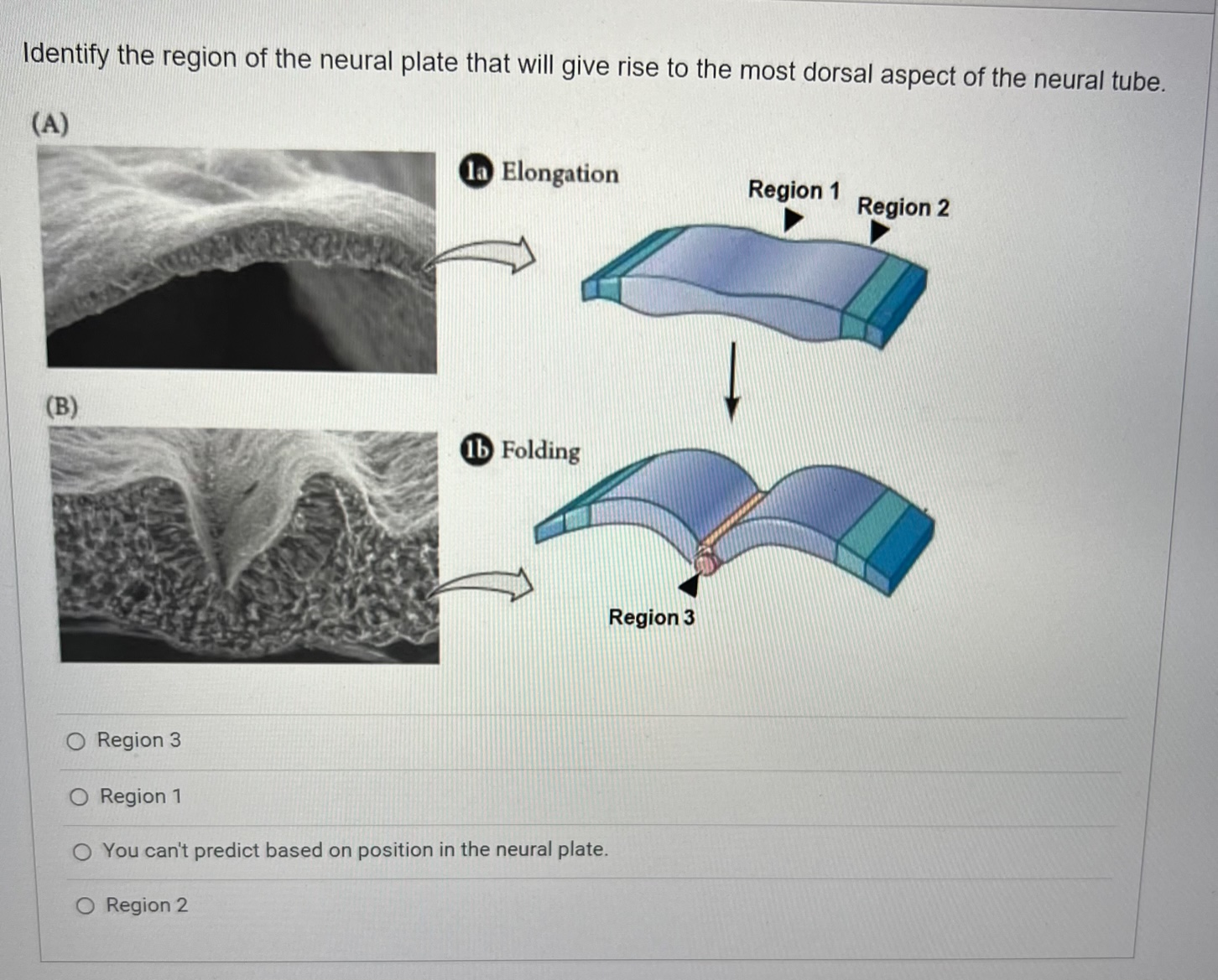 Solved Identify the region of the neural plate that will | Chegg.com