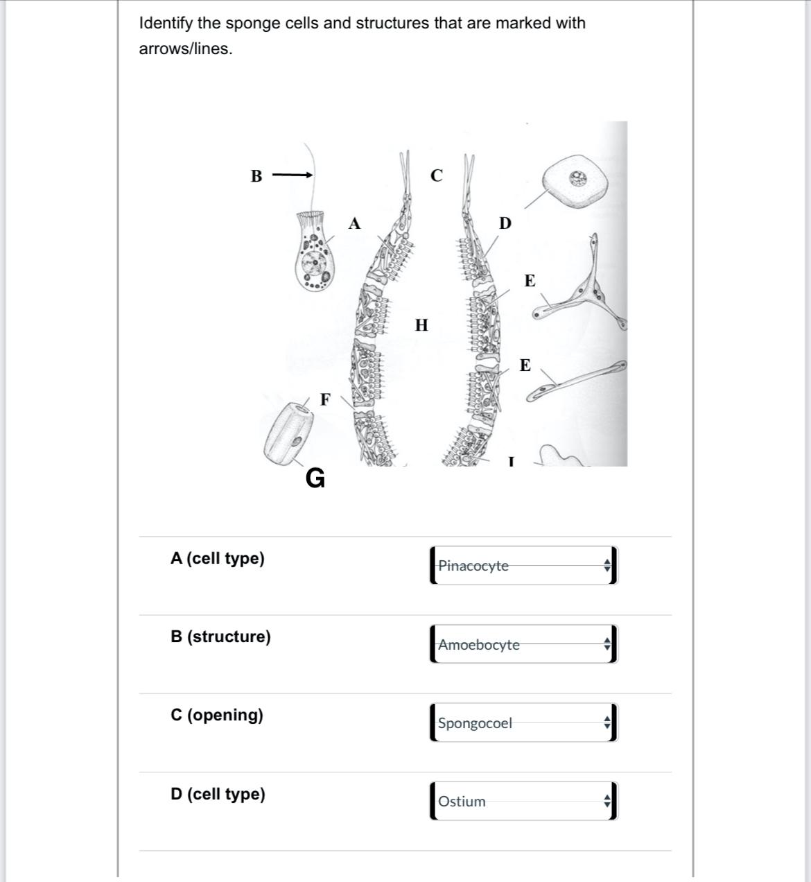 Solved Identify the sponge cells and structures that are | Chegg.com