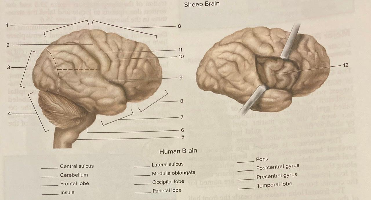 Solved Sheep Brain Central sulcus Lateral sulcus Cerebellum | Chegg.com