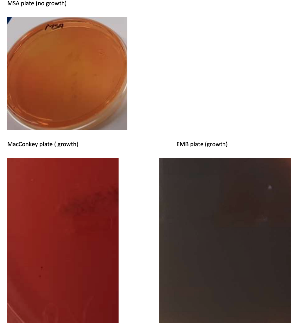 Solved SIM test Glucose TSI MacConkey plate ( growth) EMB | Chegg.com