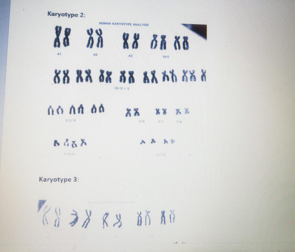 Solved Paragraph Question 6 - Human Karyotype Analysis (10 | Chegg.com
