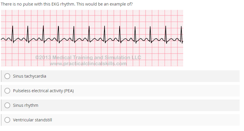 Solved There is no pulse with this EKG rhythm. This would be | Chegg.com