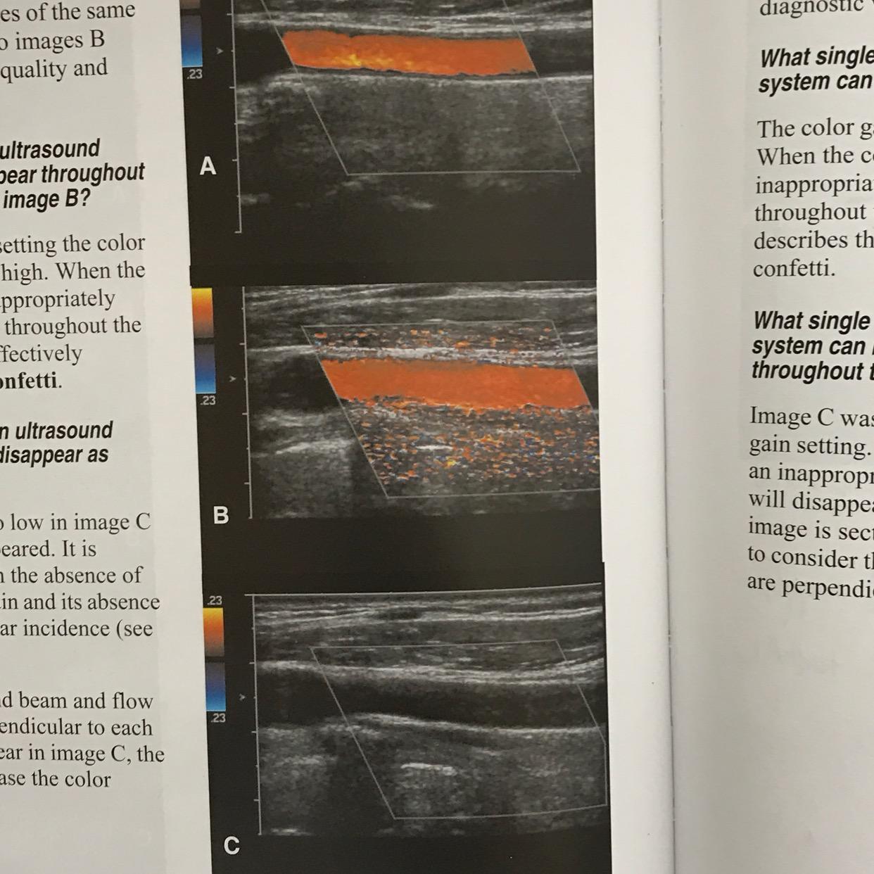 Ghosting In Color Doppler