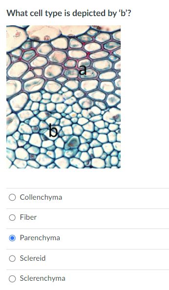 Solved What cell type is depicted by | Chegg.com