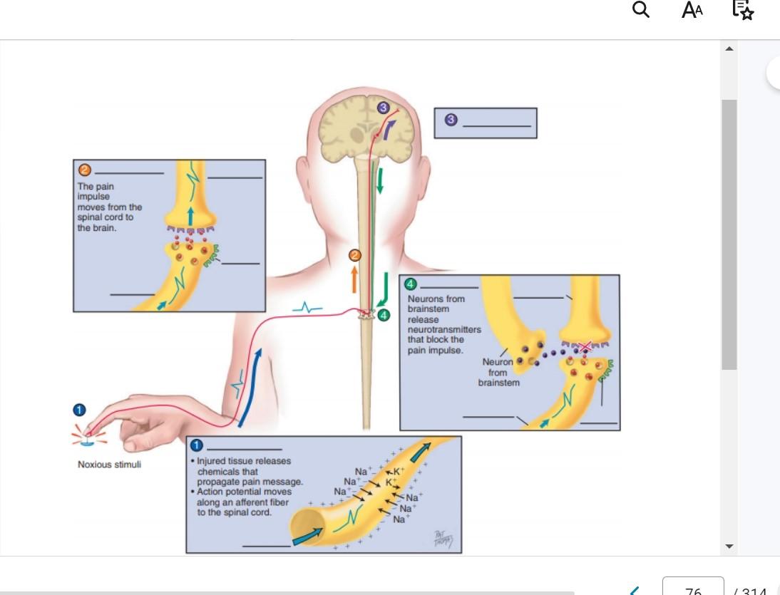 Solved Q AA Thomas 3 2 The pain impulse moves from the | Chegg.com