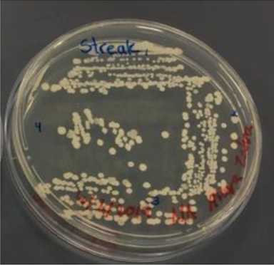 Solved These two plates were made using streak plate method | Chegg.com