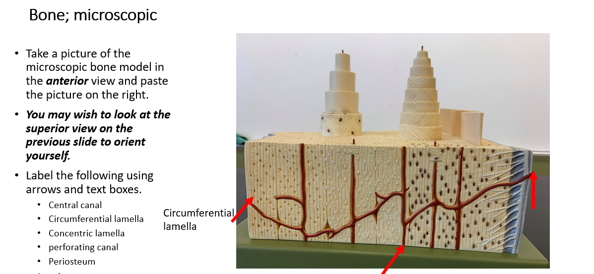 Solved Bone; microscopic - Take a picture of the microscopic | Chegg.com