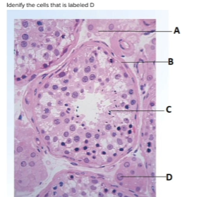 Solved Idenify the cells that is labeled D A B с D D | Chegg.com