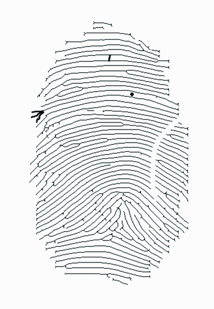 Solved Scar Bifurcation Ridge Ending Island Bridge Eye or | Chegg.com